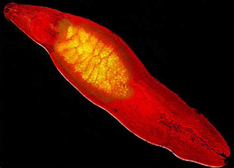 Human Liver Fluke Nikons Microscopyu
