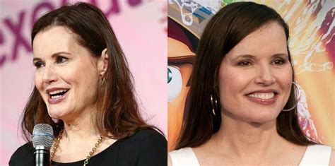 Geena Davis Before And After Plastic Surgery 7 Celebrity Plastic Surgery Online