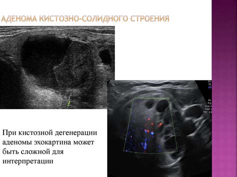 Ультразвуковое исследование щитовидной железы презентация онлайн