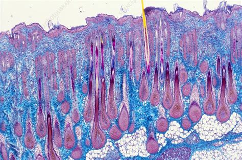 Hairy Scalp Skin Light Micrograph Stock Image C0154958 Science Photo Library