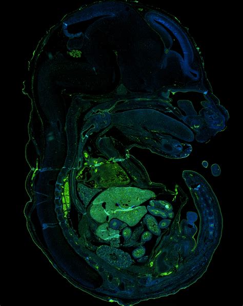 Mouse Embryo FFPE Section E15 5 Labeled With Claudin 1 Antibody BiCell Blue