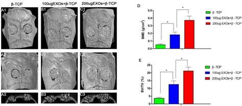 the analysis of hipsc msc exos β tcp scaffolds promoted bone