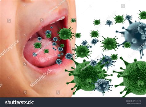 Mouth Infection Bacteria At Christopher Hurtado Blog