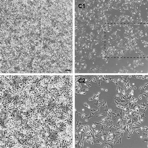 Selective Detachment Of Hipsc Derived Neural Progenitor Cells Npcs Download Scientific