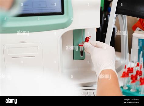 Blood Analysis On Analyzer In Laboratory Close Up Laboratory Assistant