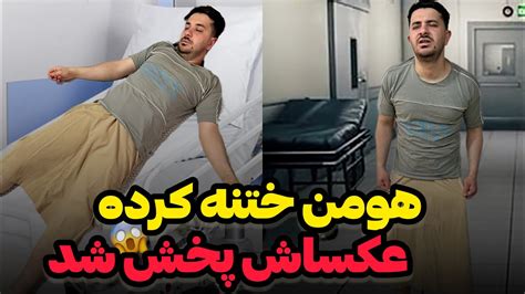 عکس اونجای هومن وایرال شده 😨 شایعه کردن توی 30 سالگی ختنه کرده Youtube