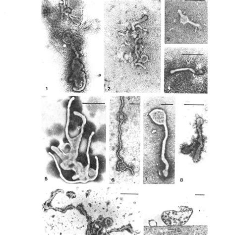 Pdf Rapid Detection By Transmission Electron Microscopy Of Mycoplasma