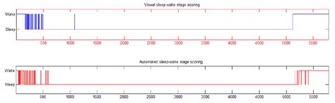 Hypnogram Of Visual Scoring Vs Automatic Sleep Wake Detection For Download Scientific Diagram