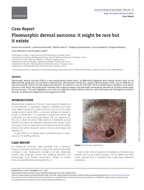 Pdf Pleomorphic Dermal Sarcoma It Might Be Rare But It Exists