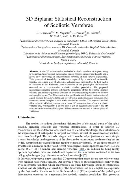 Pdf Three Dimensional Surface Rendering Reconstruction Of Scoliotic