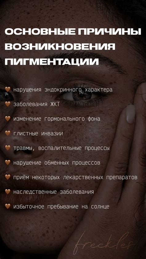Пигментация на лице сторис