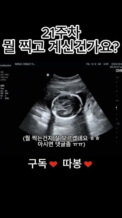 21주 초음파 뭘 찍는 건가요 Youtube