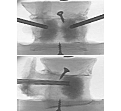 Radiographs In Anteroposterior And Lateral Projections After