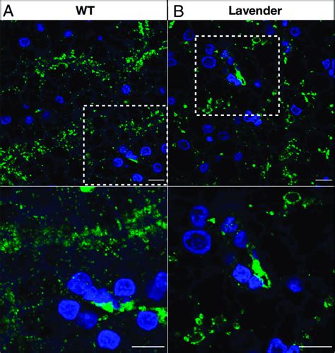 Lamp1 Immunostaining Of Liver Cells A Lysosomes Of The Wild Type Download Scientific Diagram
