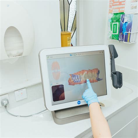 ITero Digital Scanner Custom Treatment Planning Links Orthodontics