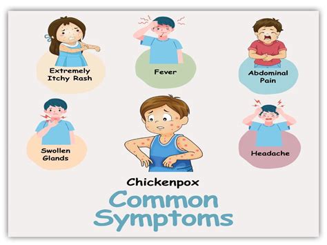Case Presentation On Chickenpox Ppt Chnpptx