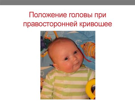 Массаж и гимнастика при врожденной мышечной кривошее презентация онлайн