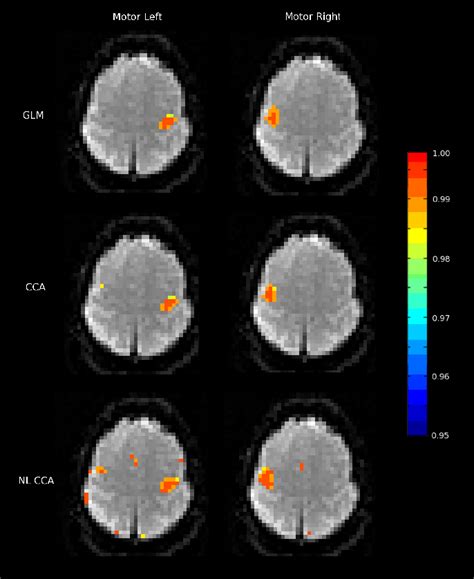 Pdf A Functional Connectivity Inspired Approach To Non Local Fmri