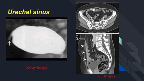 ASU MCU RADIOLOGY IMAGING PROCEDURE PPTX Reproductive Health Diseases And Conditions