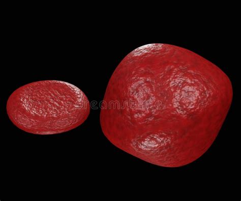 Macrocytic Anemia Stock Illustrations 8 Macrocytic Anemia Stock Illustrations Vectors