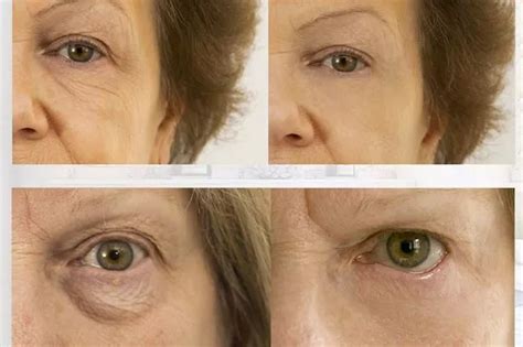The £19 Number One Bestselling Beverly Hills Instant Eye Lift Serum