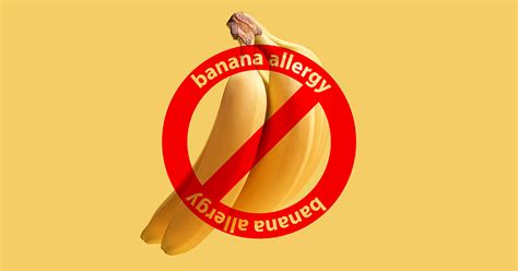 Allergy To Bananas And Latex