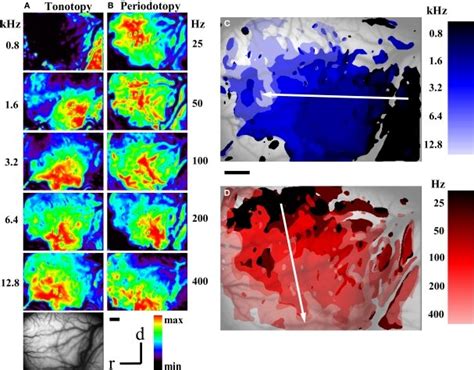 Optical Imaging Of Intrinsic Signals In Cat Auditory Cortex After Download Scientific Diagram