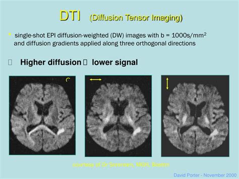 Ppt Dti Basics Water Diffusion In Mri Imaging Powerpoint Presentation Id9357815