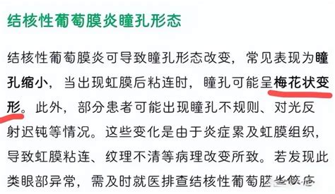 鬼灭之刃：恋雪的瞳孔为何是梅花状？这其实是作者的用心设计