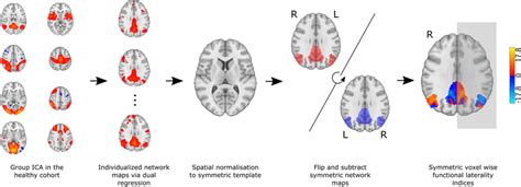 Calculation Of Functional Laterality Indices Following Temporal