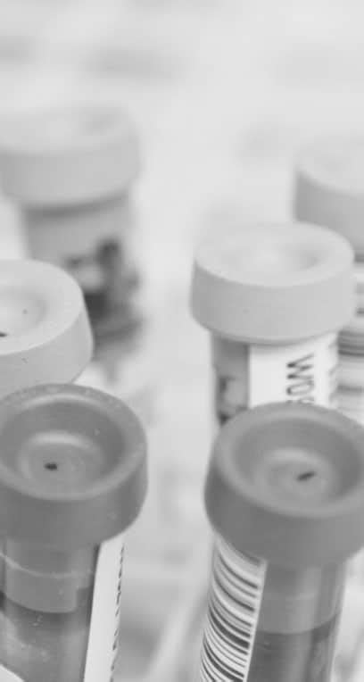 Safety V Privacy The Random Drug Testing Dilemma Getz Collins And Associates Strathmore