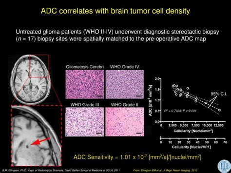 ppt functional diffusion maps fdms for brain tumor treatment response monitoring powerpoint