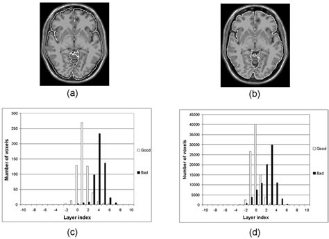 Influence Of The Parameters Of Active Contours On The Performance