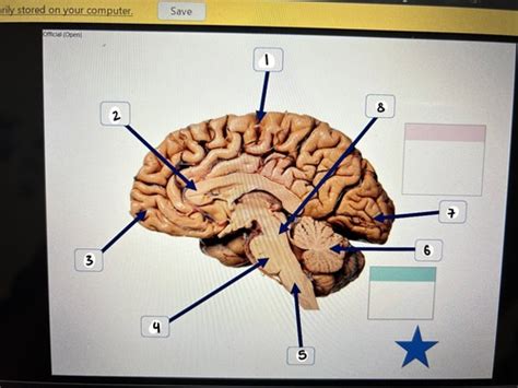 Brain Spinal Cord Lab Flashcards Quizlet