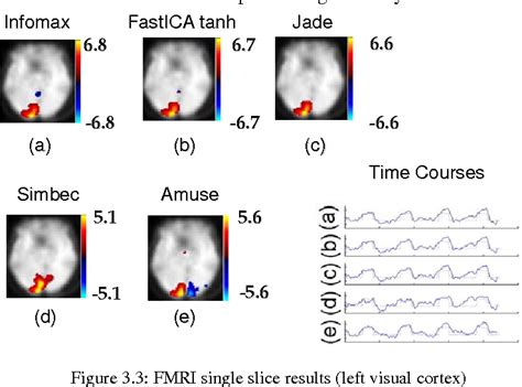 Figure 31 From Independent Component Analysis Of Bold Fmri Data