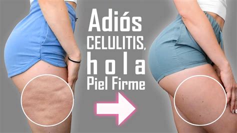 Adiós Celulitis Hola Piel Firme