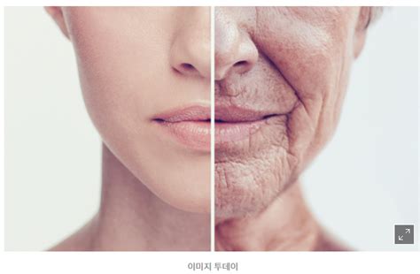 피부 노화 막아준다더니 암 전이 촉진콜라겐의 배신