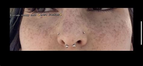 My Summer Vacation Made Them Pop R Freckledgirls