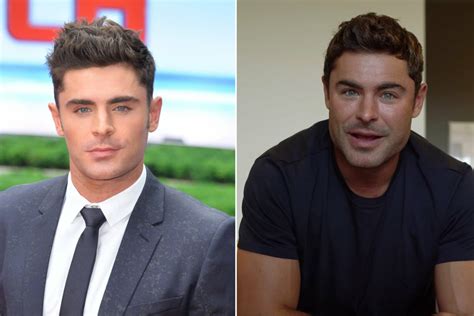 Zac Efrons Radical Transformation Leaves Many Wondering If Hes Had Plastic Surgery