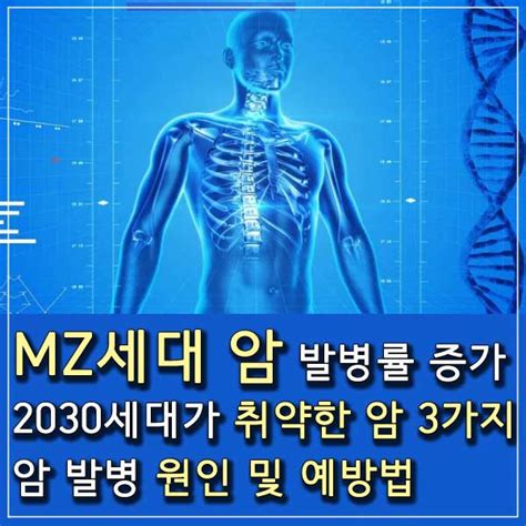 Mz세대 암 발병률 증가ㅣ취약한 암 3가지ㅣ암 발병 원인 및 예방법