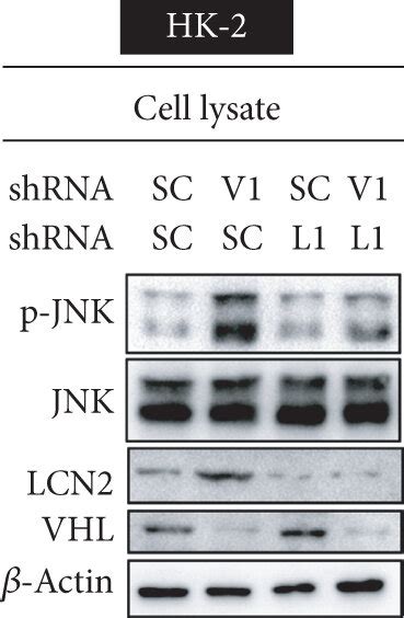Vhl Loss Of Function Exhibited An Inflammatory Response In An