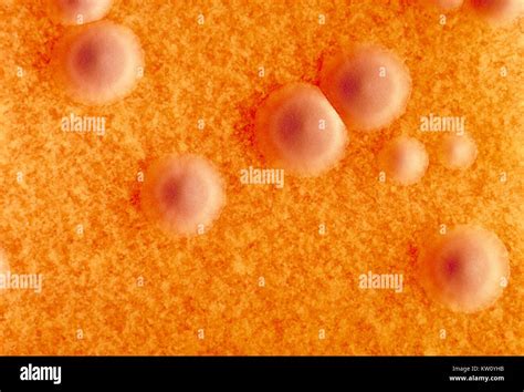 Corynebacterium Diphtheriae Colony Morphology