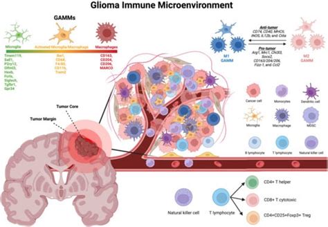 Unveiling The Inflammatory Landscape Of Recurrent Glioblastoma Through Histological Based