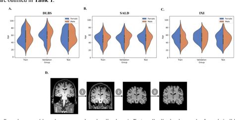 Figure 2 From Improving Across Dataset Brain Tissue Segmentation For Mri Imaging Using