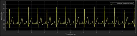 Filtered Ecg Signal Simulink Scope Download Scientific Diagram