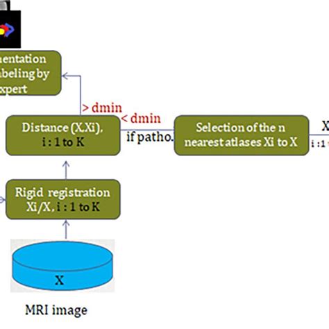 Segmentation Diagram The Figure Shows The Different Steps Of The