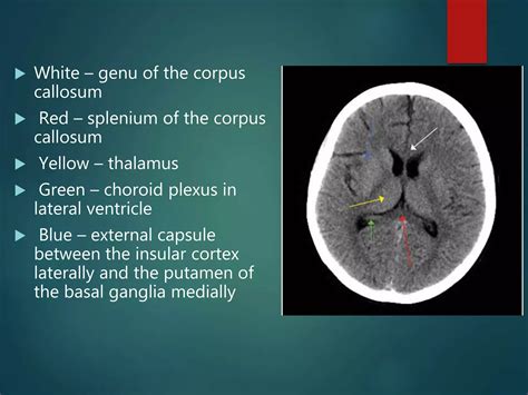 Ct Brain Interpretation Pptx