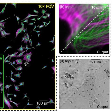super resolution and image quality enhancement using deep learning a