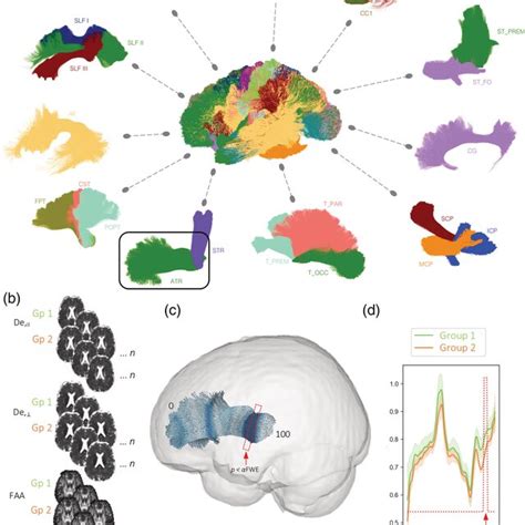 A White Matter Tracts Automatically Segmented Using Tractseg Included