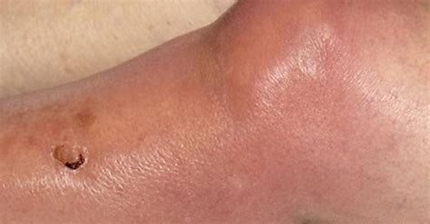 Did You Know These Things Caused Crazy Injuries Like Septic Knees Album On Imgur